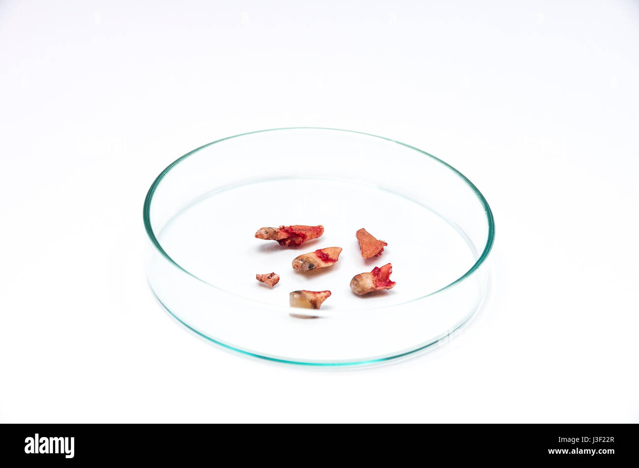 Fragments of a human tooth after extraction in a petri dish Stock Photo ...