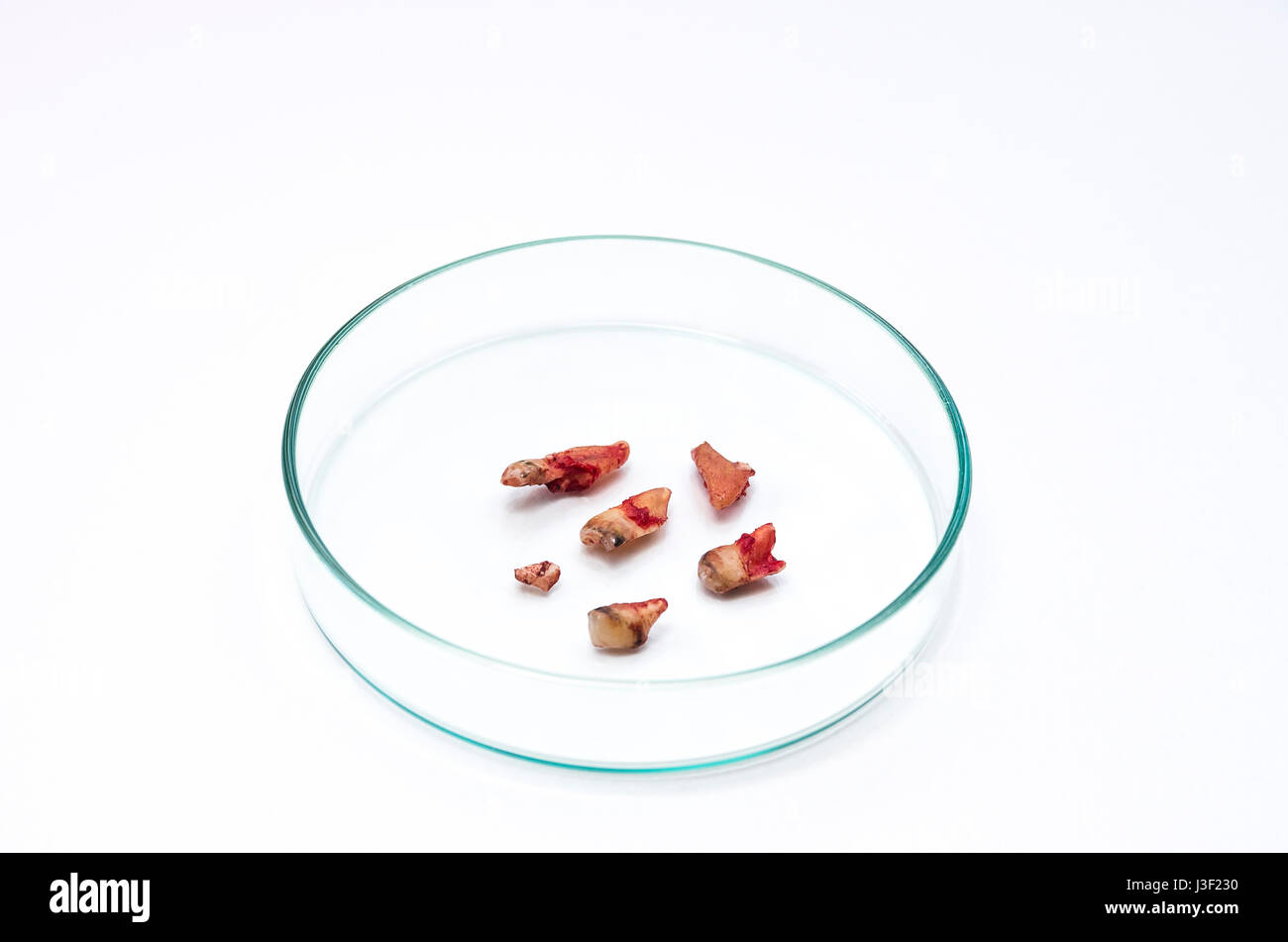 Fragments of a human tooth after extraction in a petri dish Stock Photo ...
