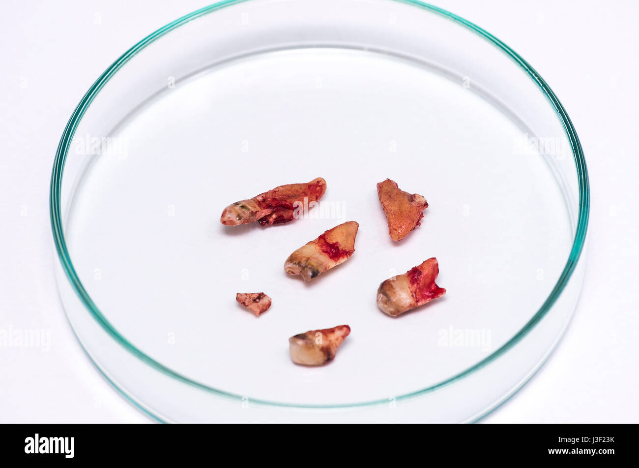 Fragments of a human tooth after extraction in a petri dish Stock Photo ...