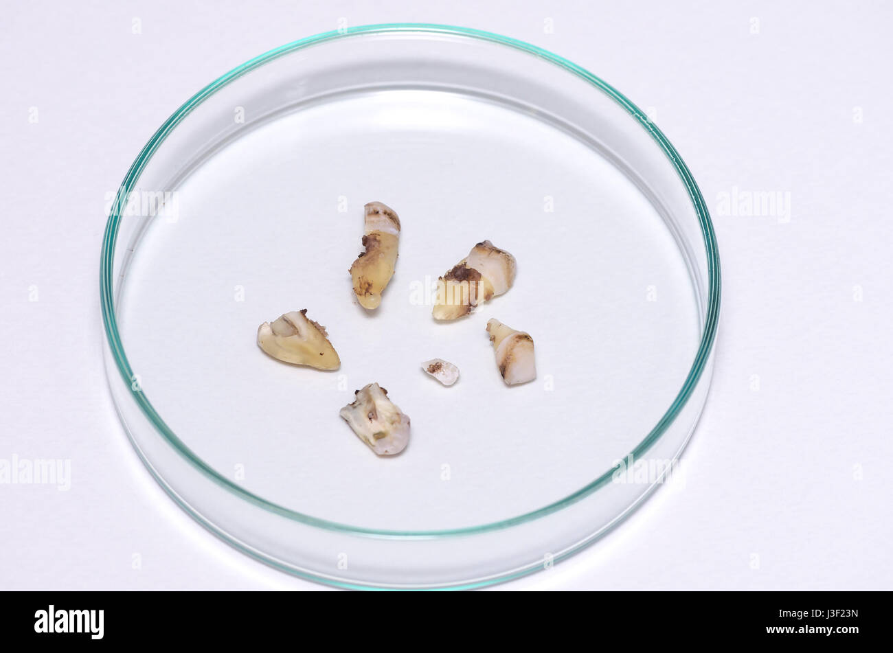 Fragments of a human tooth after extraction in a petri dish Stock Photo ...
