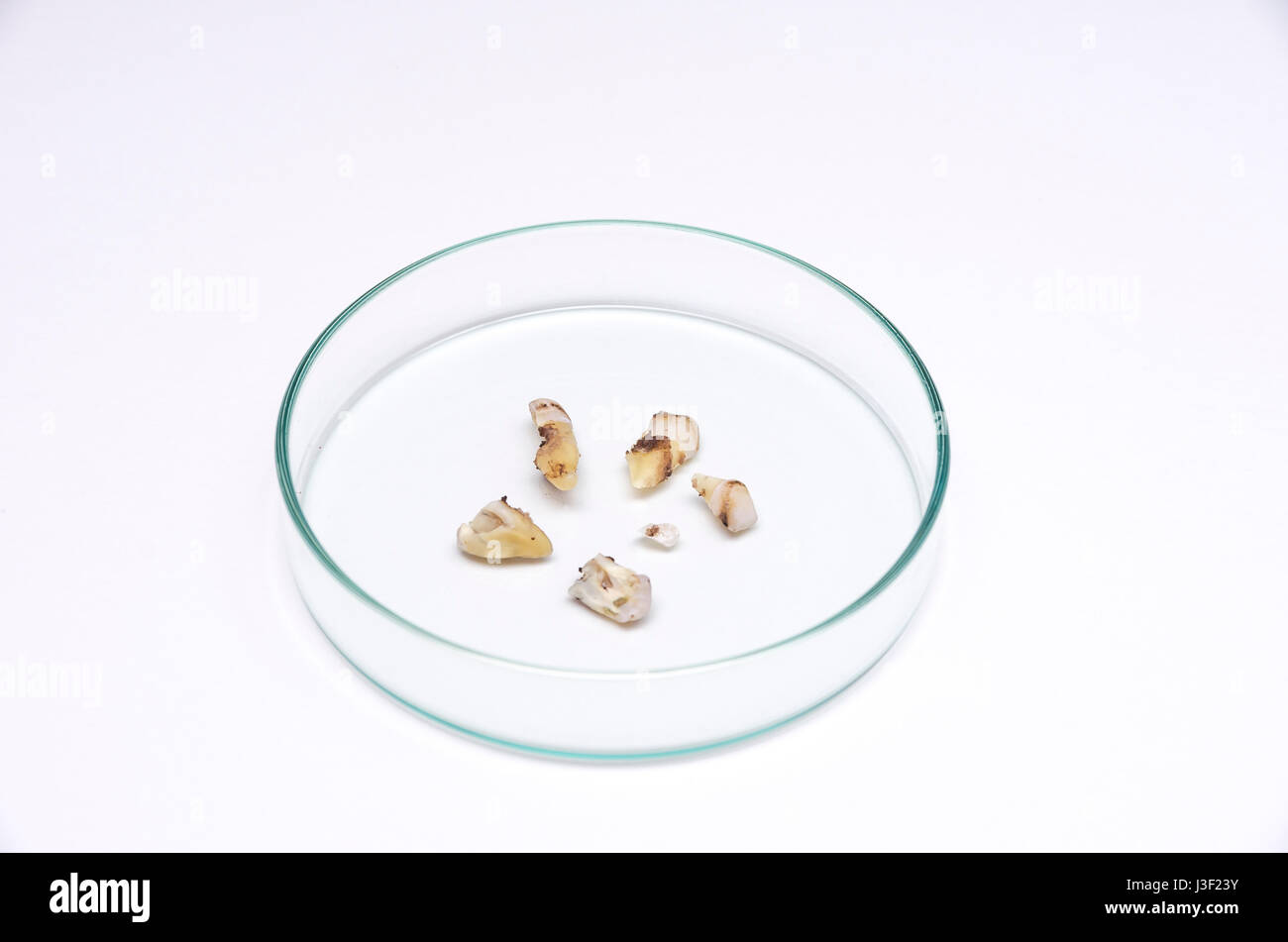 Fragments of a human tooth after extraction in a petri dish Stock Photo ...