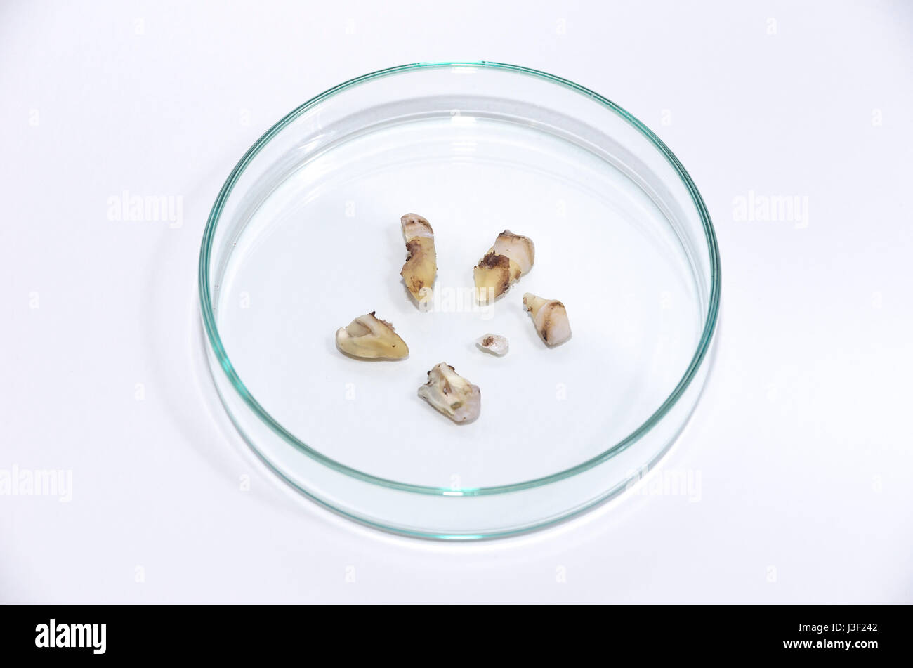 Fragments of a human tooth after extraction in a petri dish Stock Photo ...