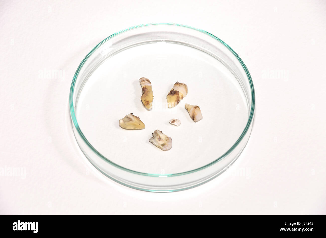 Fragments of a human tooth after extraction in a petri dish Stock Photo ...