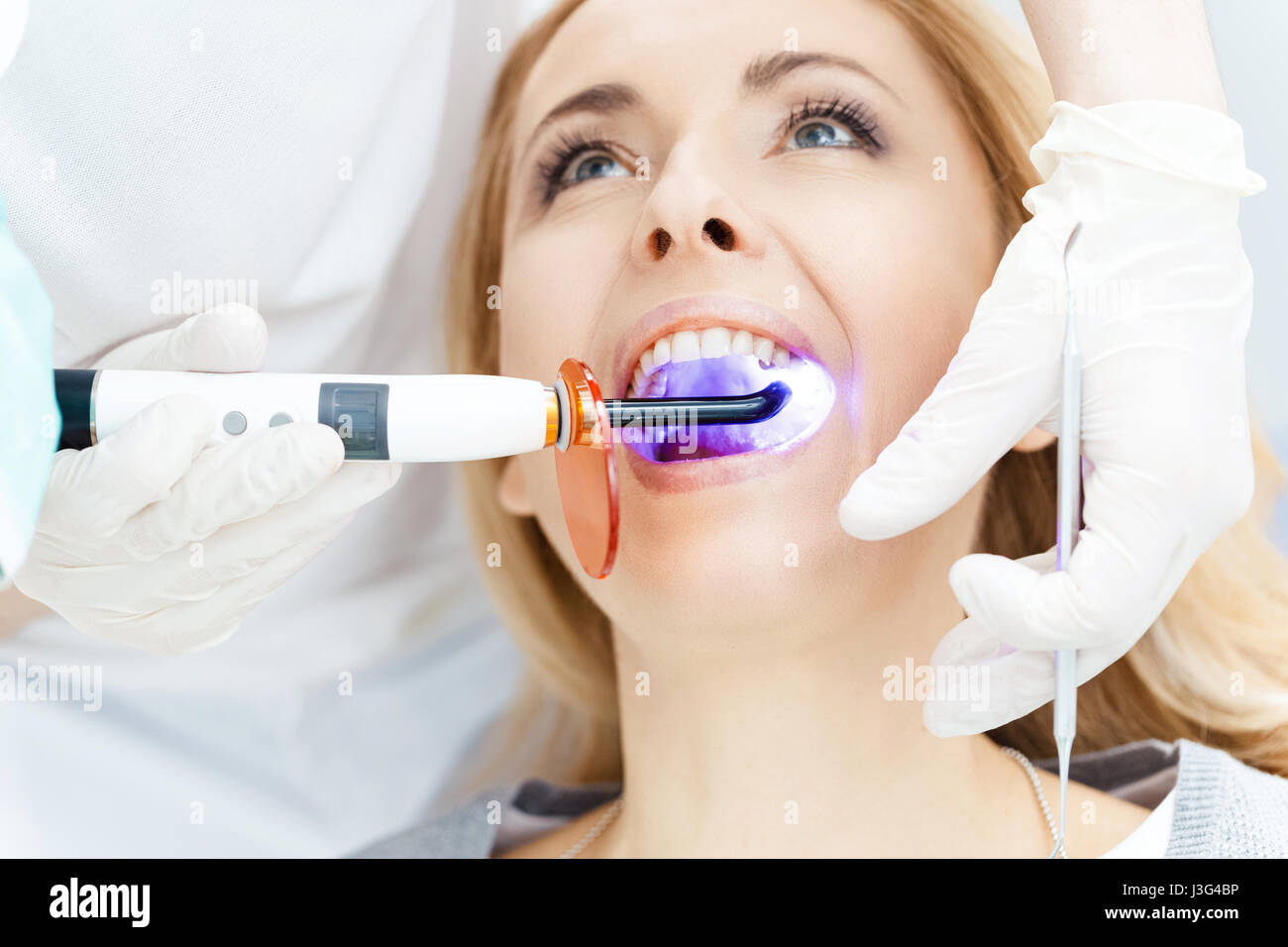 Dental uv hi-res stock photography and images - Alamy