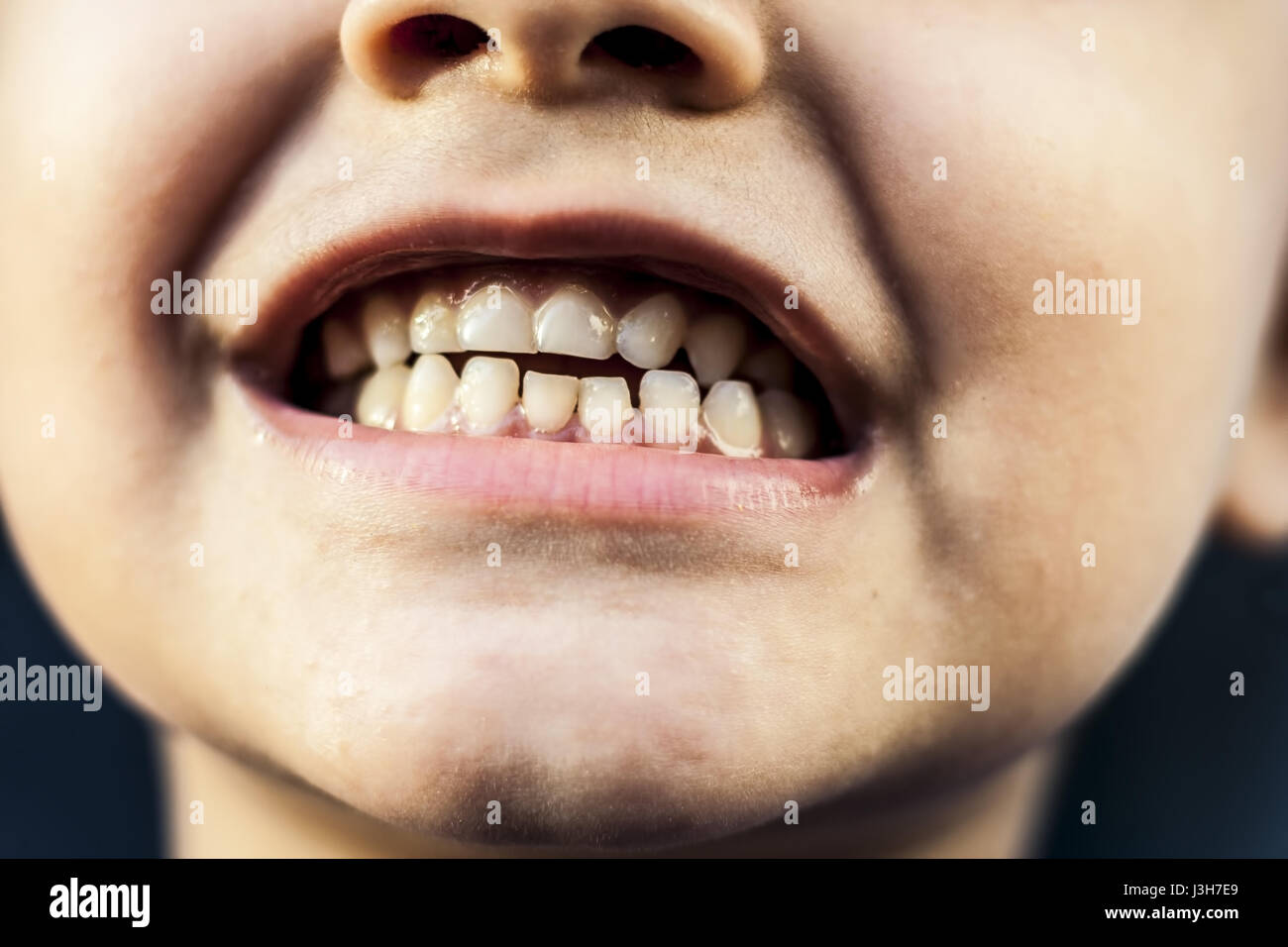 A boy showing his teeth Stock Photo - Alamy