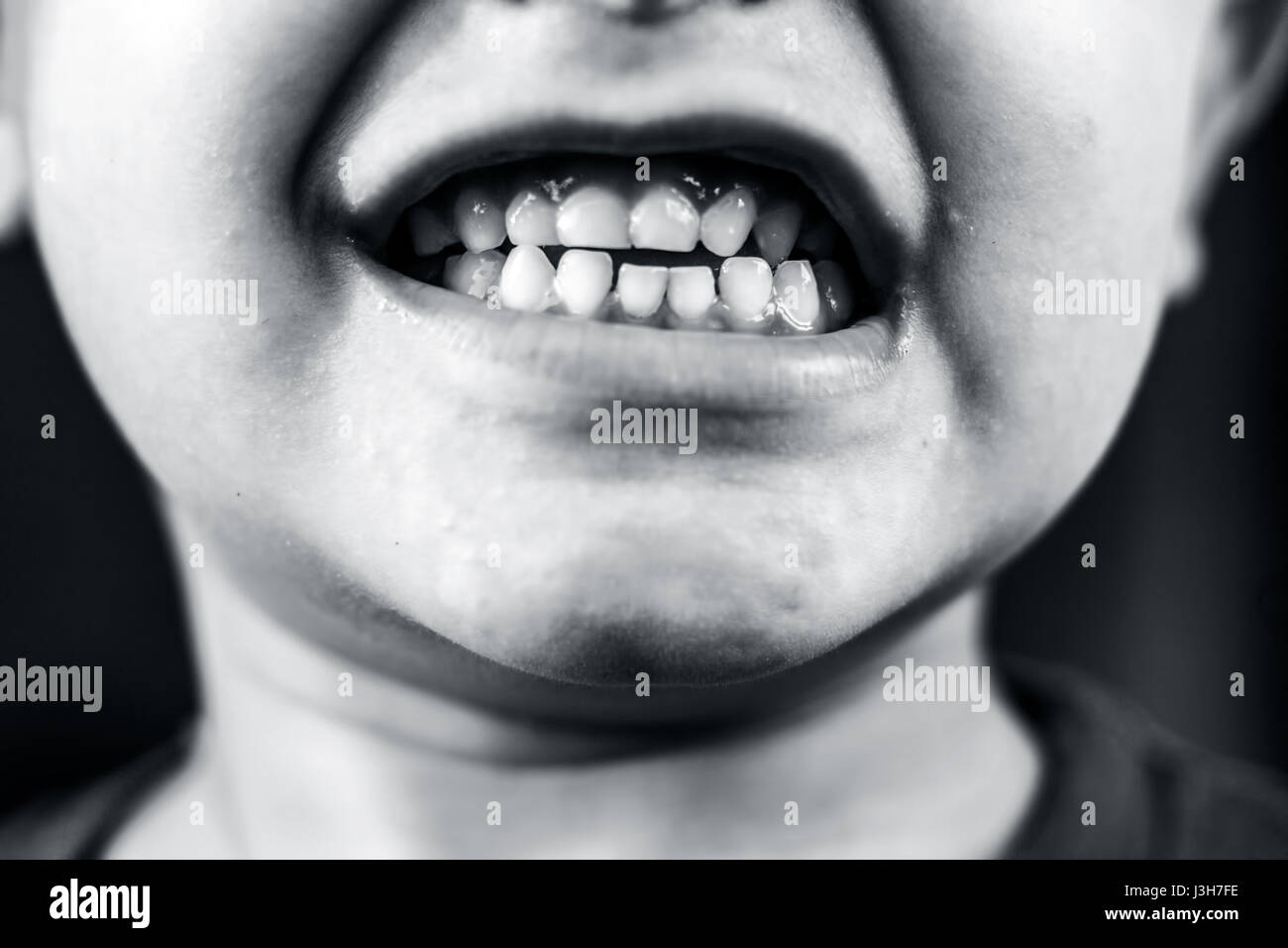 A boy showing his teeth Stock Photo - Alamy