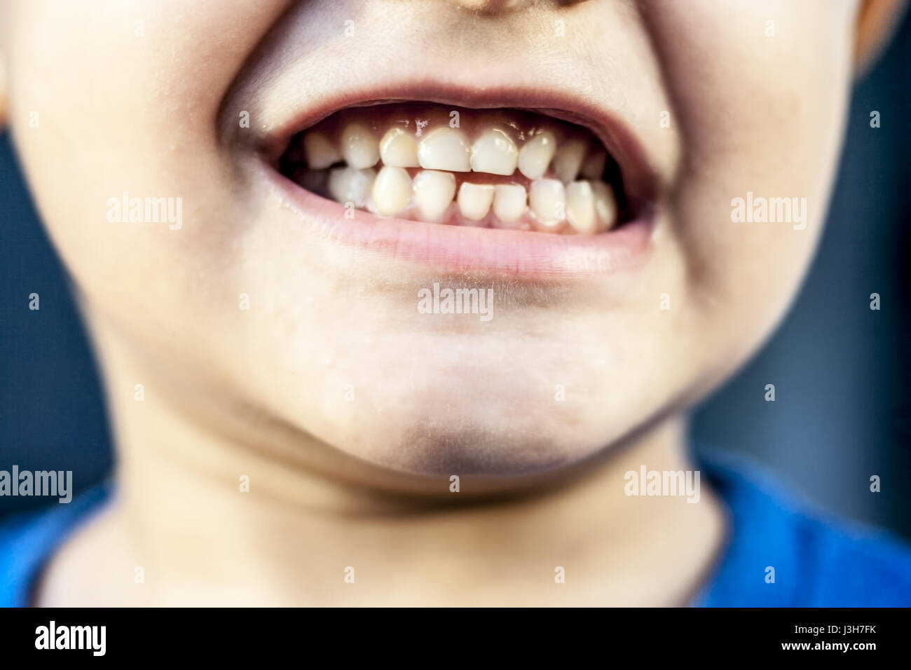 A boy showing his teeth Stock Photo - Alamy