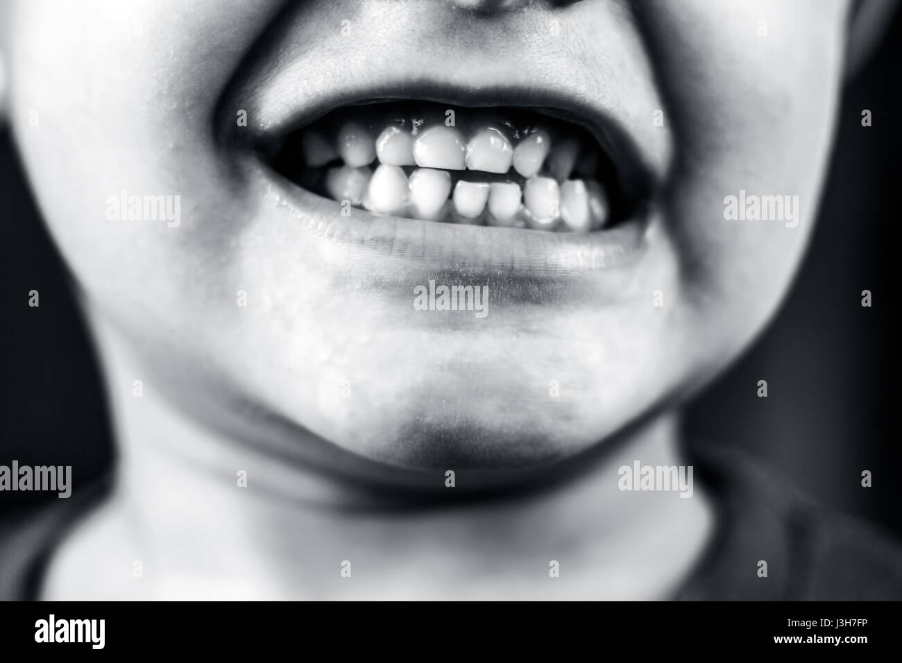 A boy showing his teeth Stock Photo - Alamy