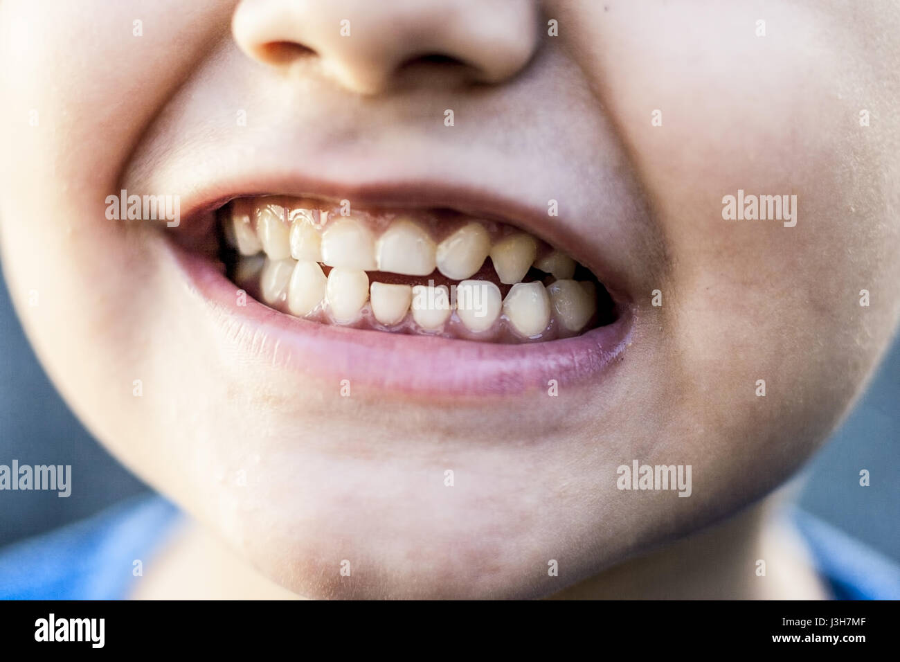A boy showing his teeth Stock Photo - Alamy