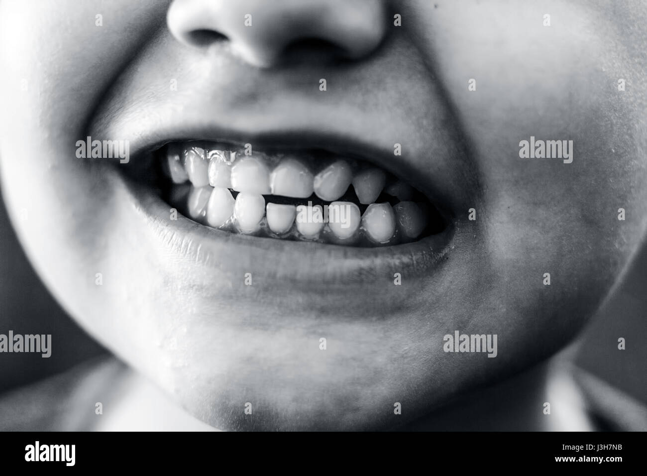 A boy showing his teeth Stock Photo - Alamy