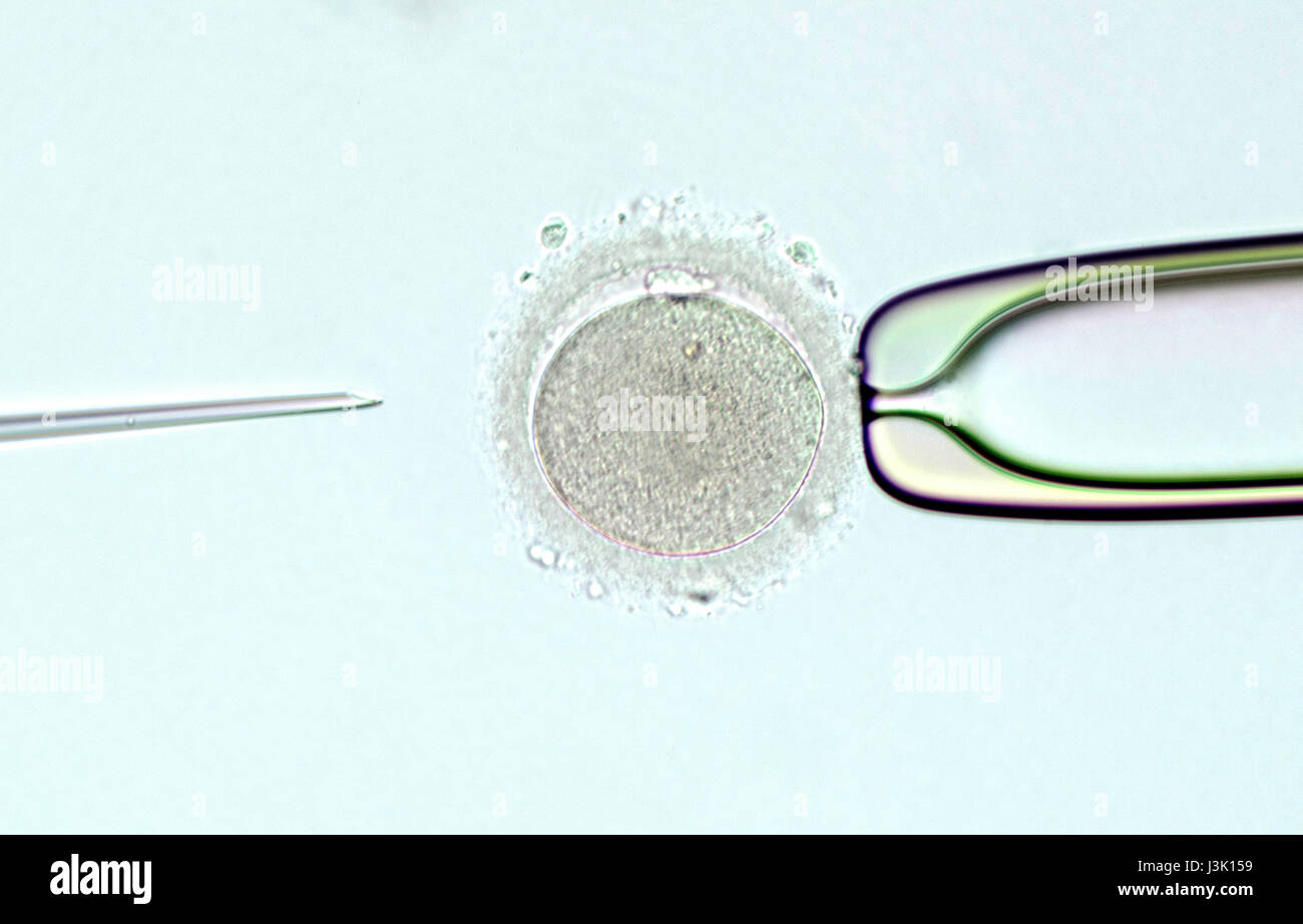 Human sperm with dna hi-res stock photography and images - Alamy