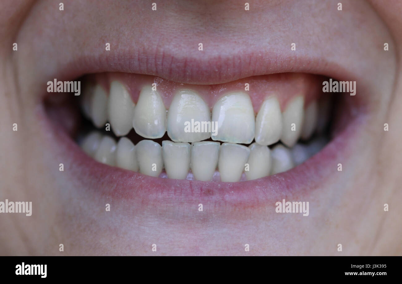 Healthy teeth hi-res stock photography and images - Alamy