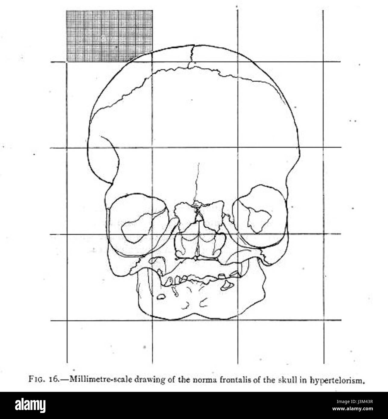 Facial skull Black and White Stock Photos & Images - Alamy