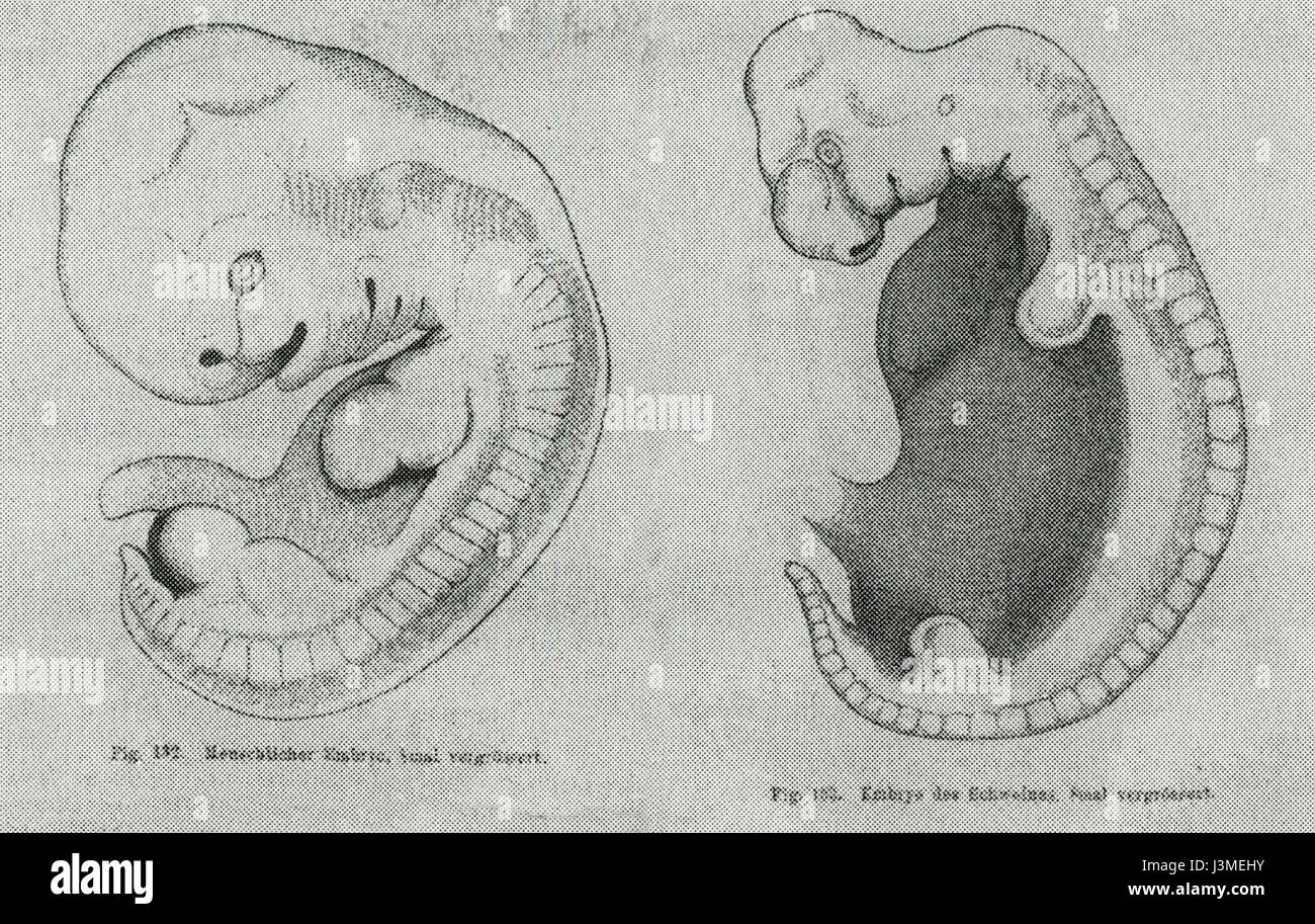 Embryo photo hi-res stock photography and images - Alamy