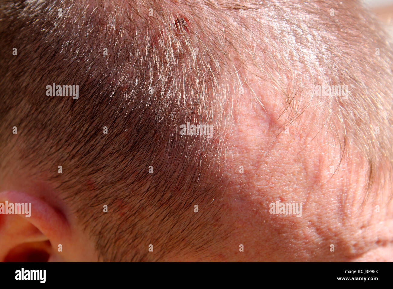 A boy with blood on his head from an injury Stock Photo - Alamy