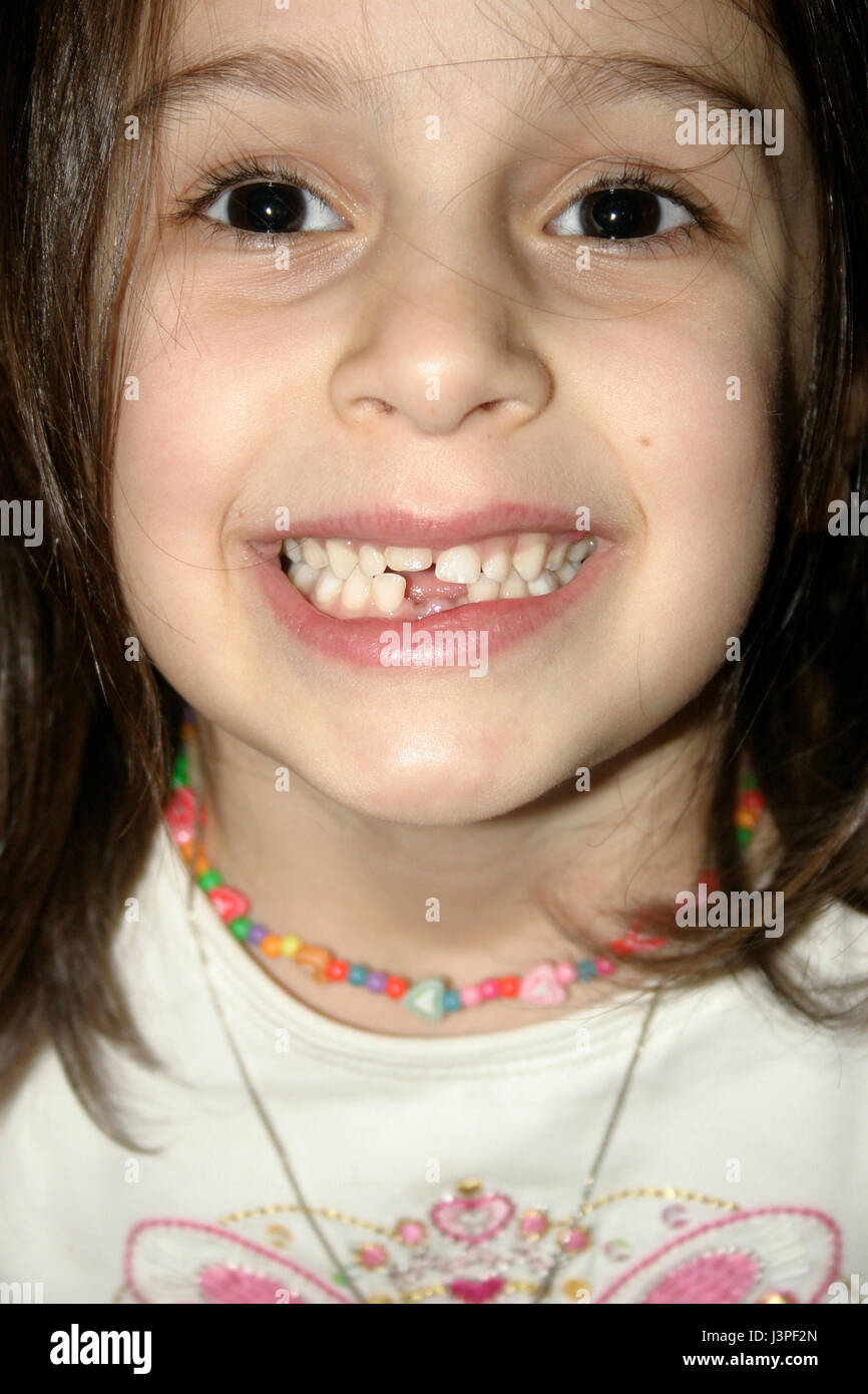 Little girl showing her teeth with her first missing tooth Stock Photo ...