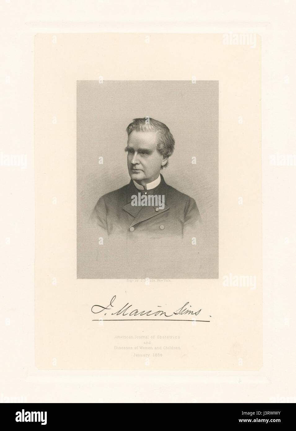 J. Marion Sims was a pioneering American doctor known for his work in ...