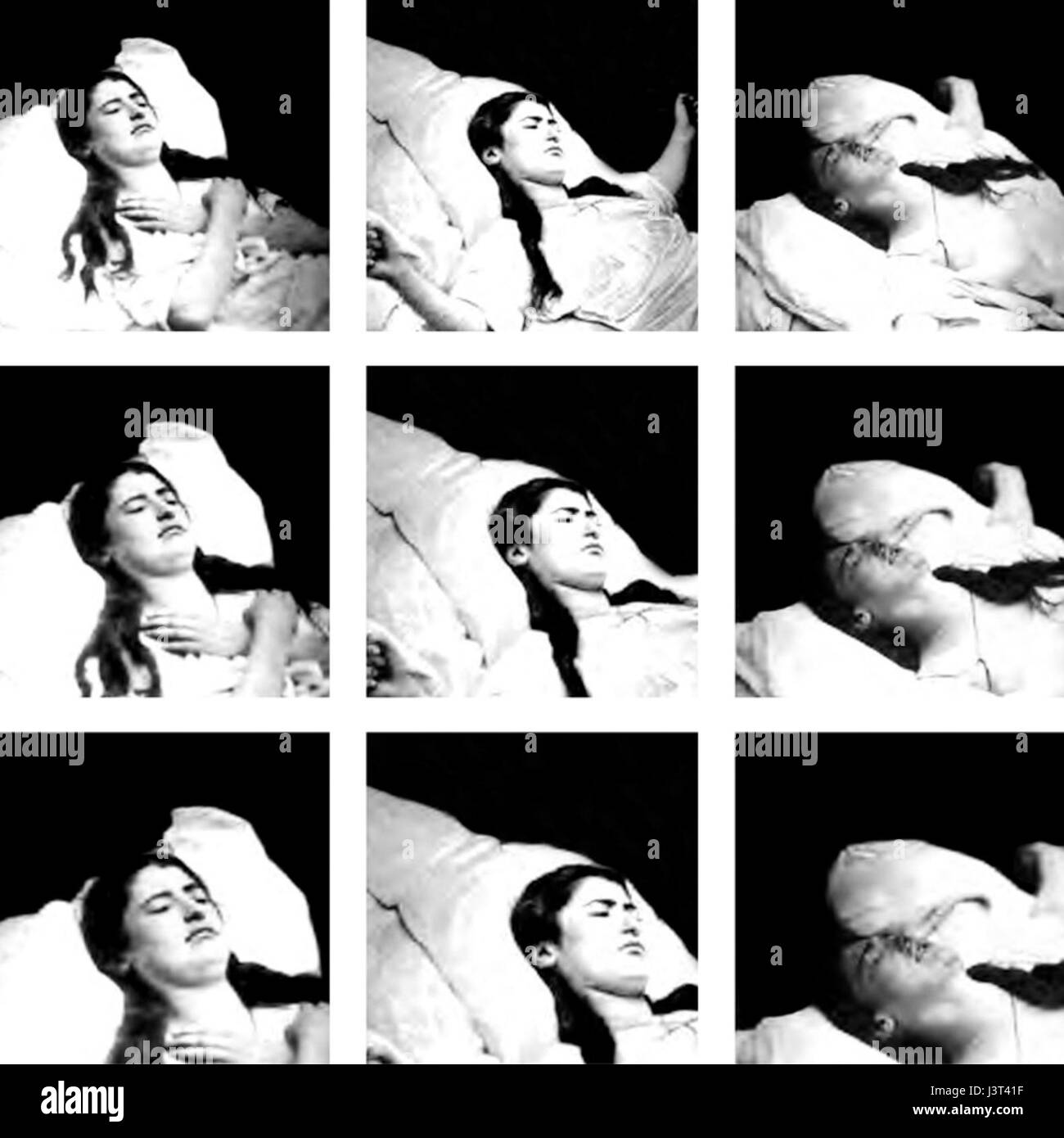 Jean Martin Charcot, a French neurologist, studied hysteria using ...