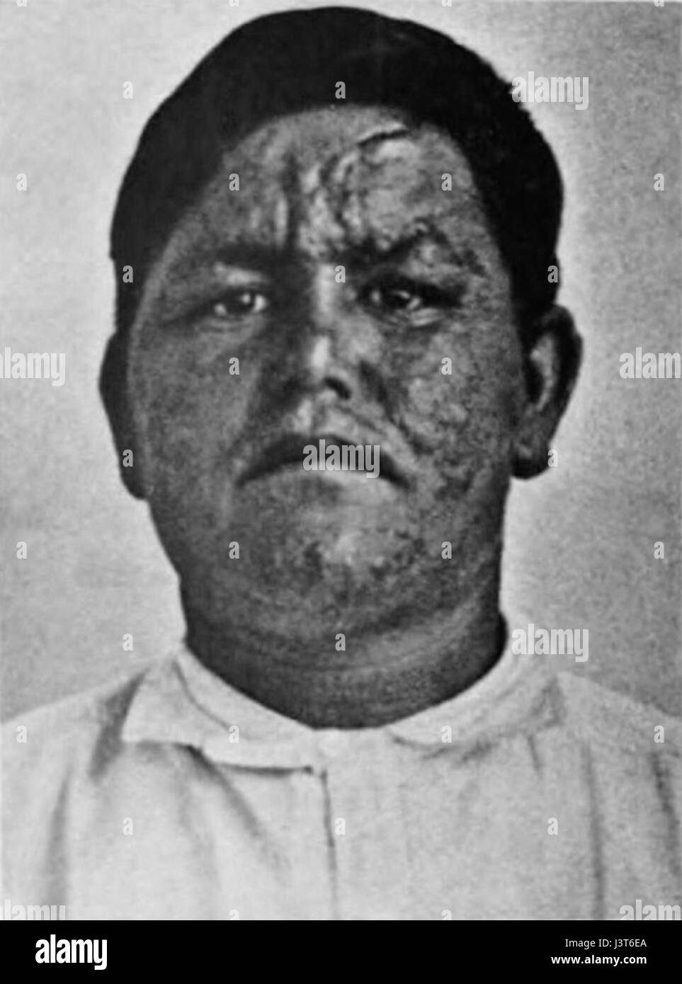 Keanu the Leper is a historical figure known for his unique story ...