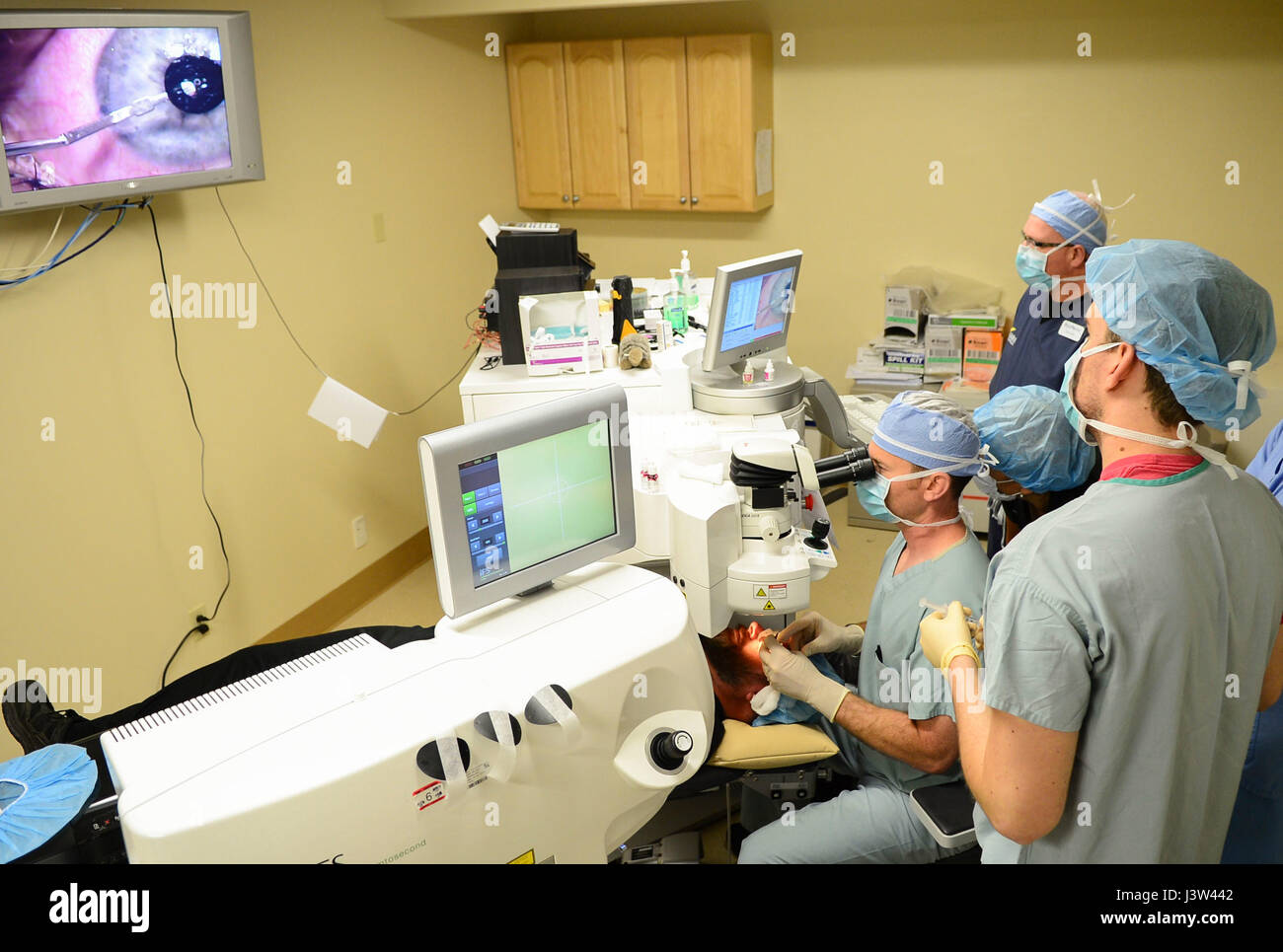 A KAMRA corneal inlay procedure was performed at the Naval Training ...