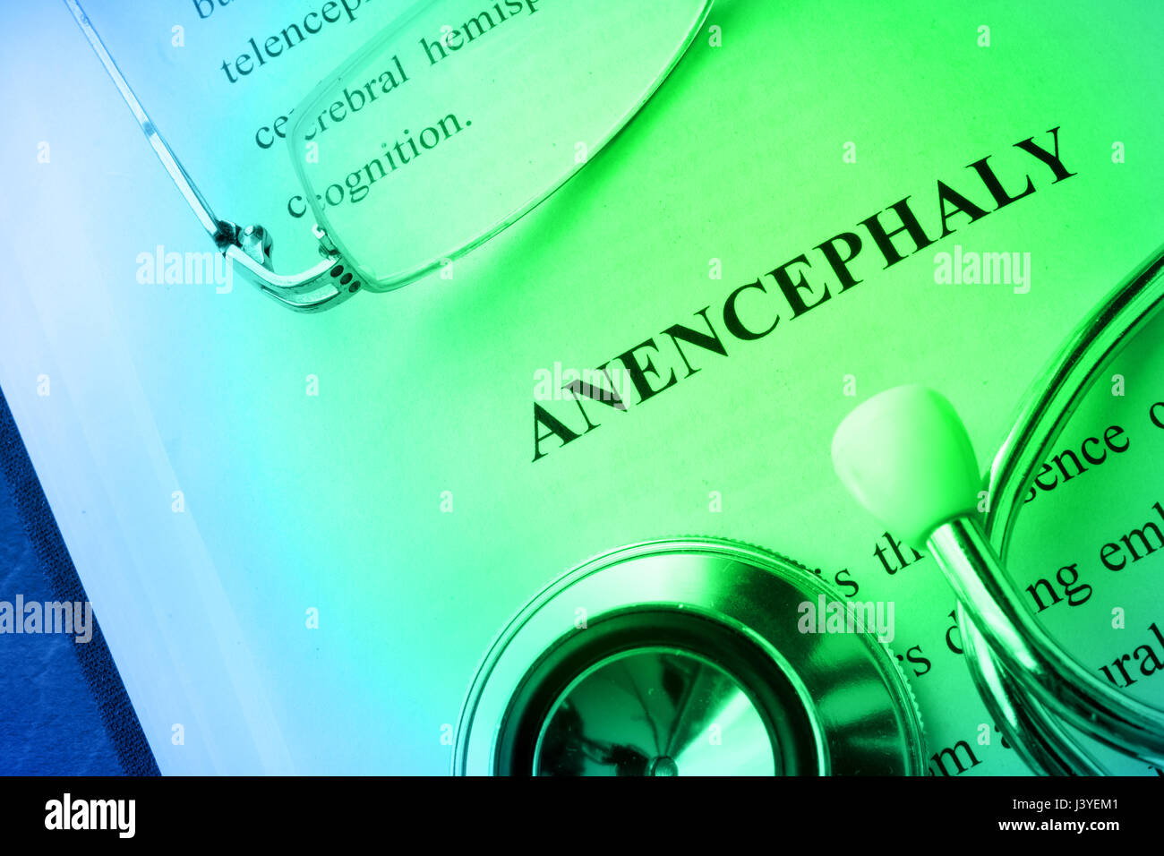 Anencephaly hi-res stock photography and images - Alamy