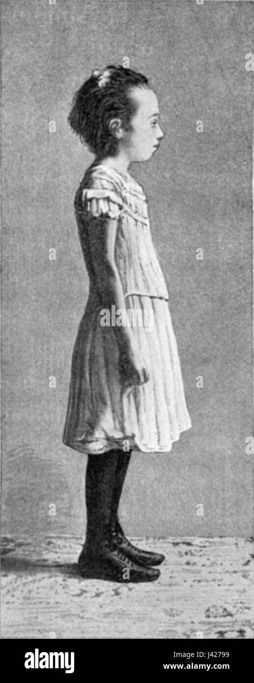 La mene avec la brassiere ordinaire Stock Photo - Alamy