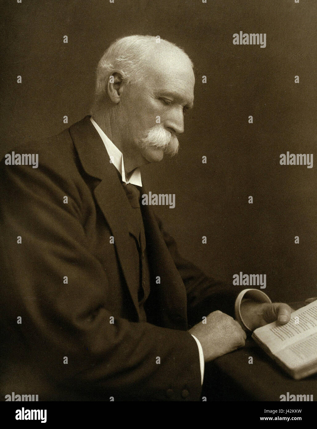 MacEwen was a prominent surgeon and neurosurgeon, known for his ...