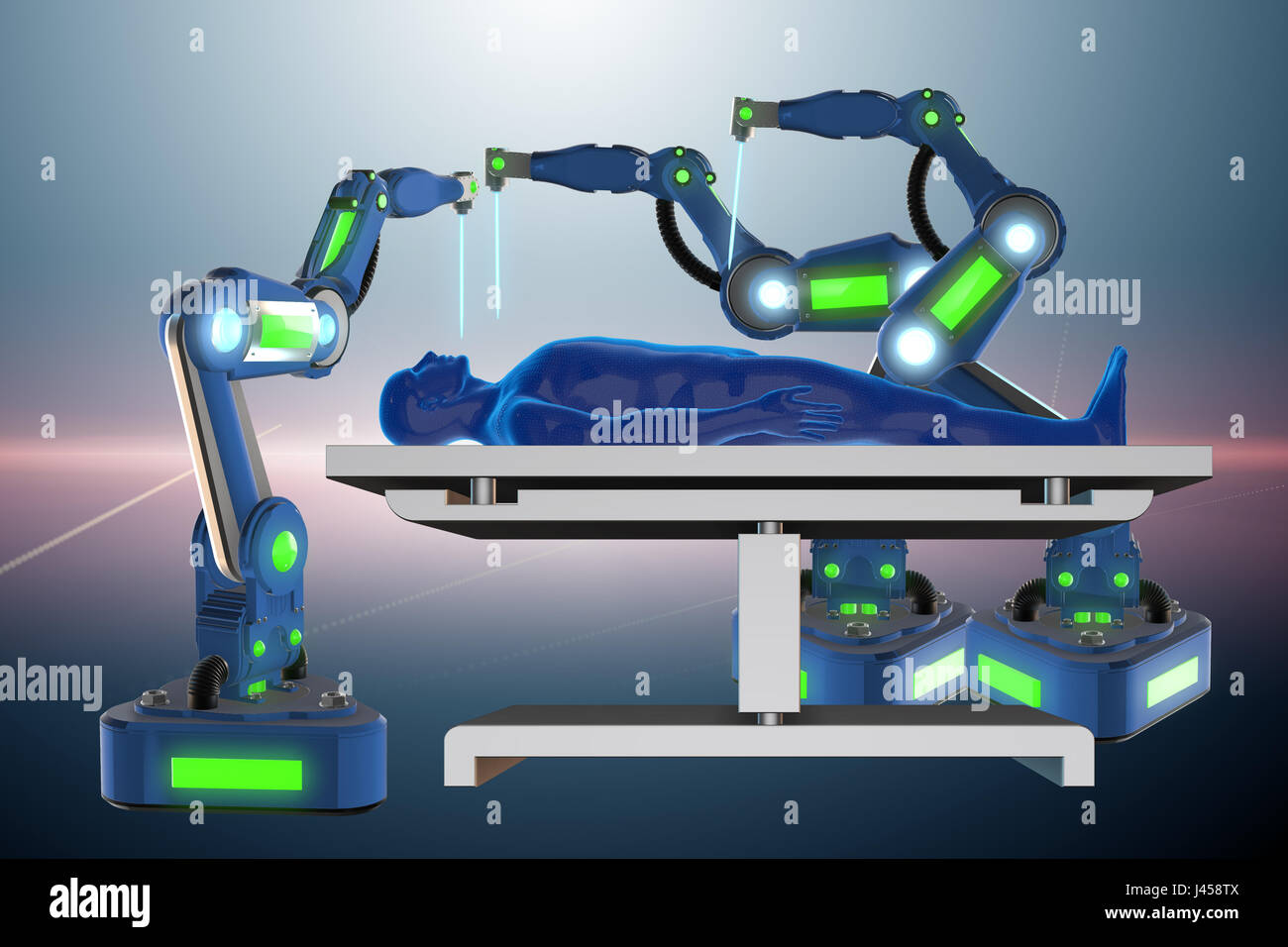 Surgery performed by robotic arm Stock Photo - Alamy