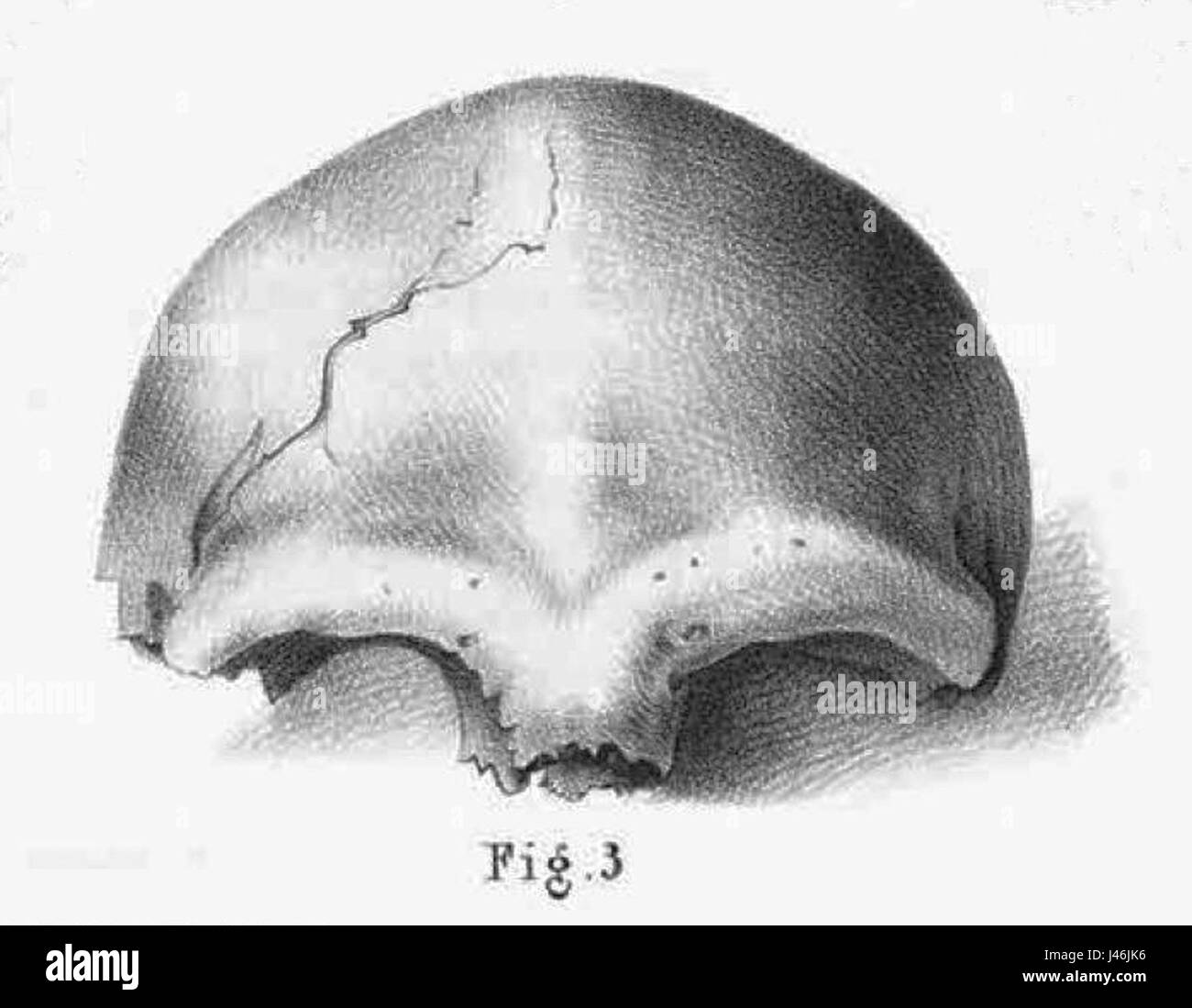 The Neandertal 1 Calvarium B is a fossilized human skull, a significant ...