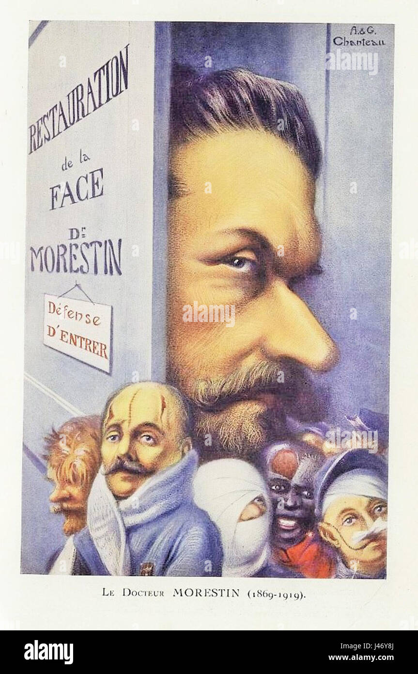 This caricature by Morestin humorously depicts a figure in exaggerated ...