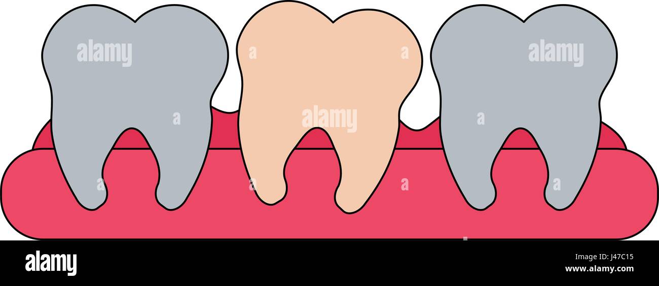 color image cartoon set tooth in gum Stock Vector Image & Art - Alamy