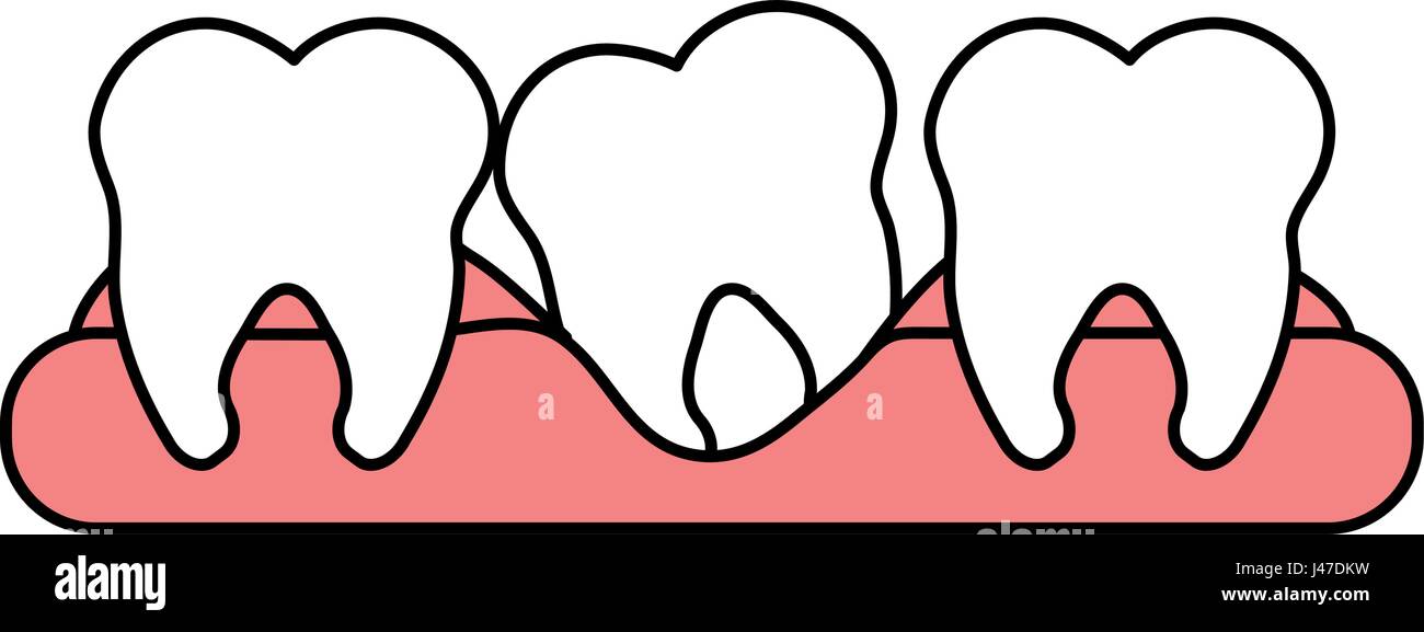 color silhouette cartoon set tooth in gum Stock Vector Image & Art - Alamy