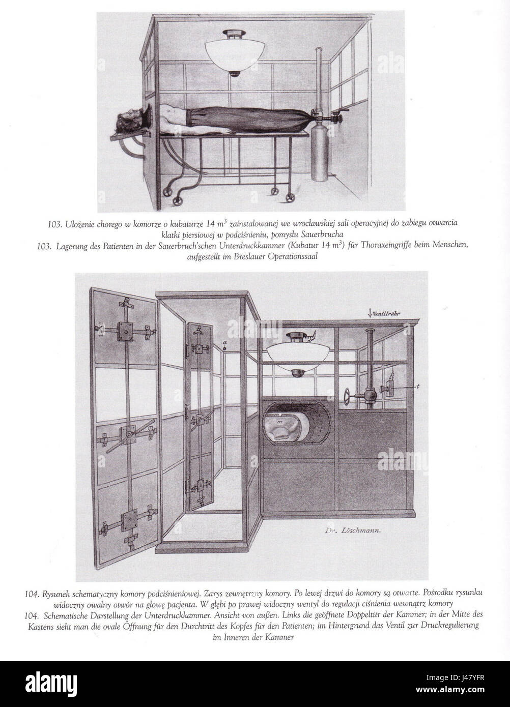 Mikulicz hi-res stock photography and images - Alamy