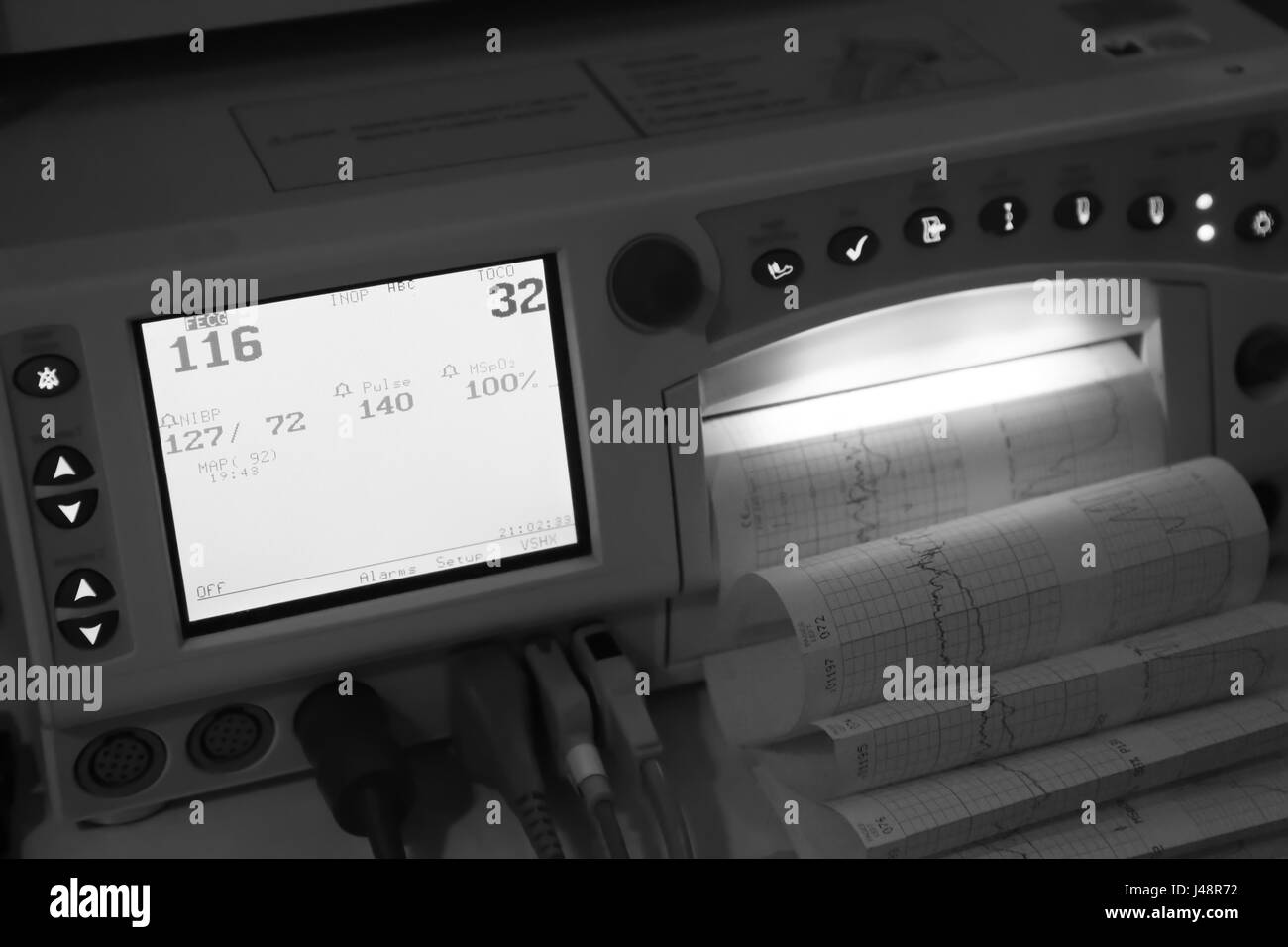 Electrocardiograph machine hi-res stock photography and images - Alamy