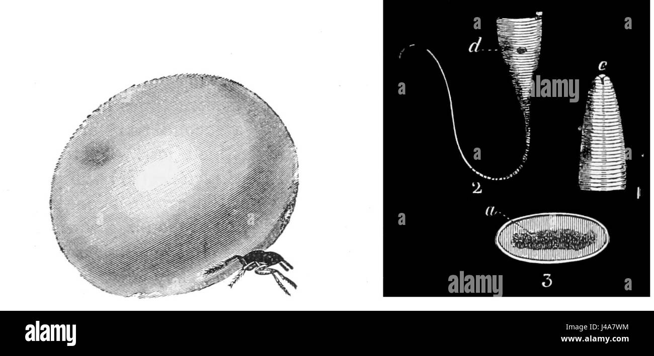 PSM V08 D703 Female chigoe and young filaria Stock Photo - Alamy