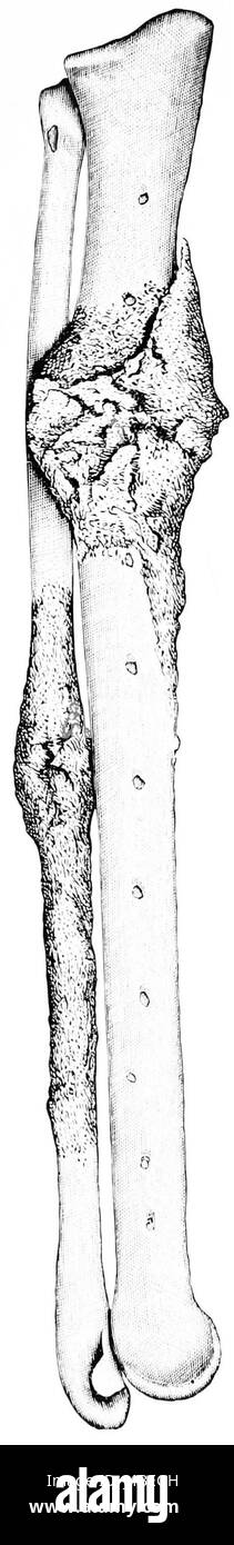 This illustration from *Popular Science Monthly* (Vol 42, D702) shows ...