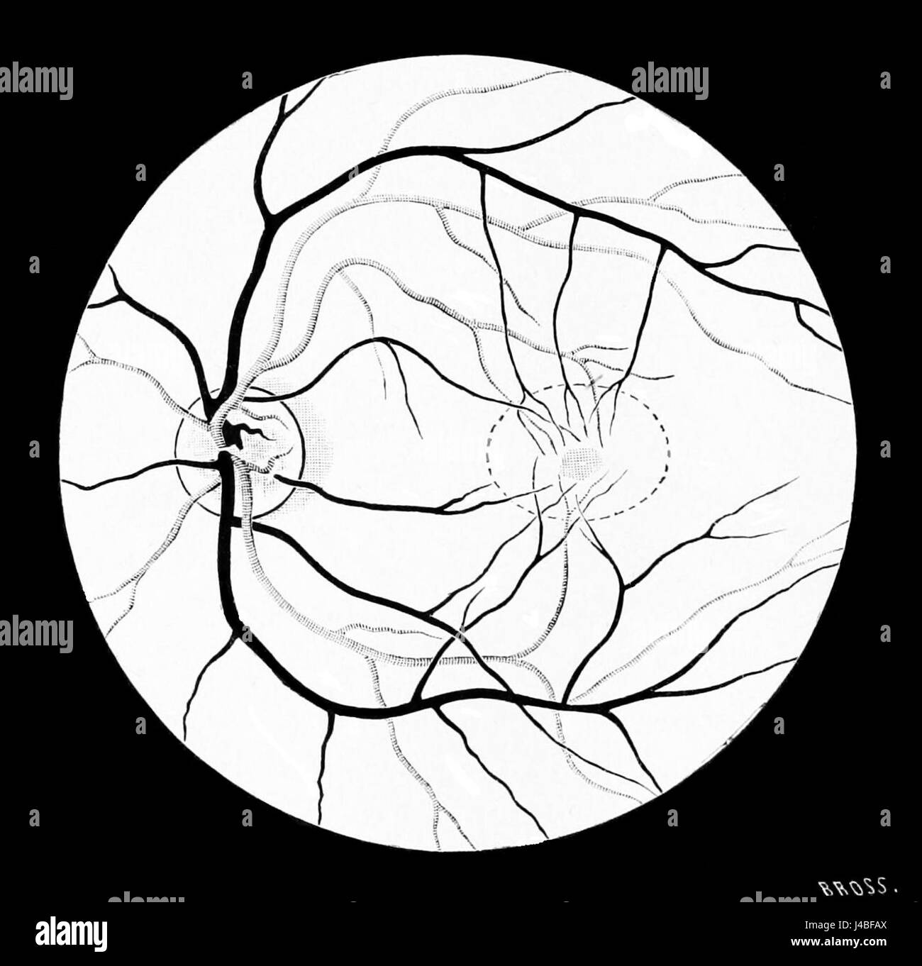 This image refers to the visual examination of the retina using an ...