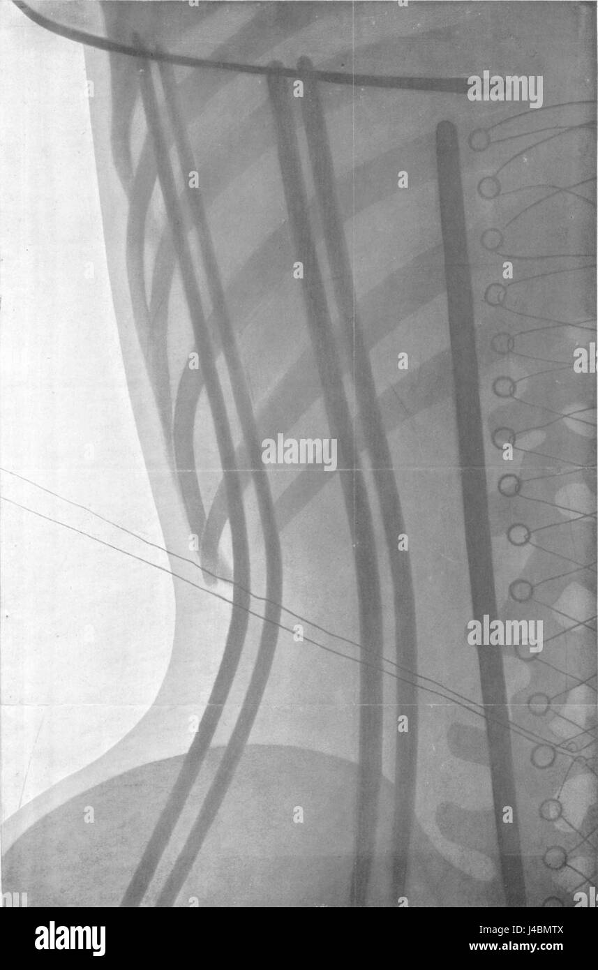 Corset structure hi-res stock photography and images - Alamy