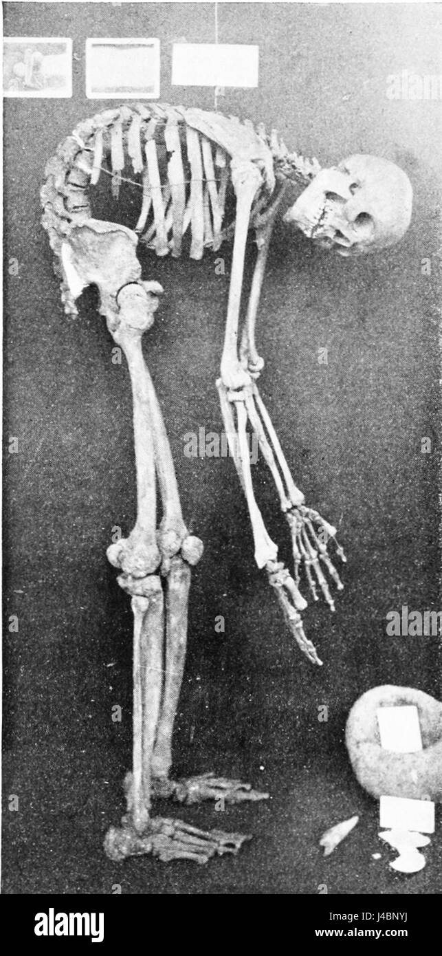 Ossified Black and White Stock Photos & Images - Alamy