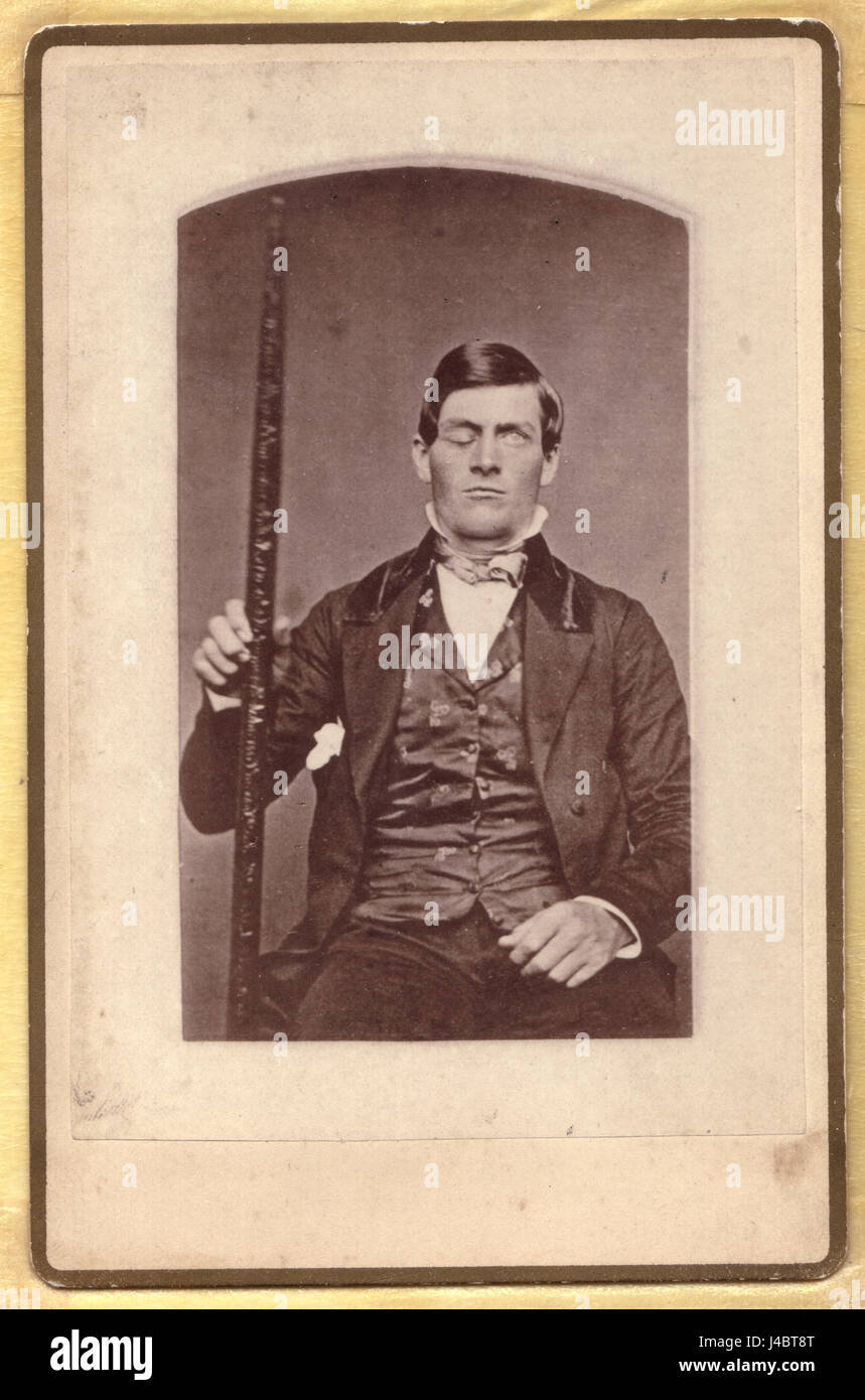 Phineas Gage (1823–1860) was an American railroad construction foreman ...