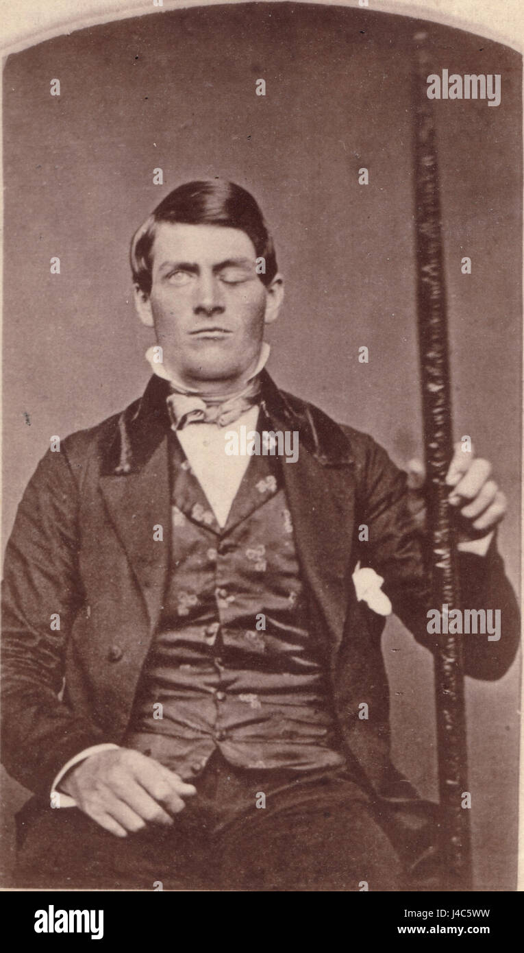Phineas Gage GageMillerPhoto2010 02 17 Unretouched Color Cropped Stock ...