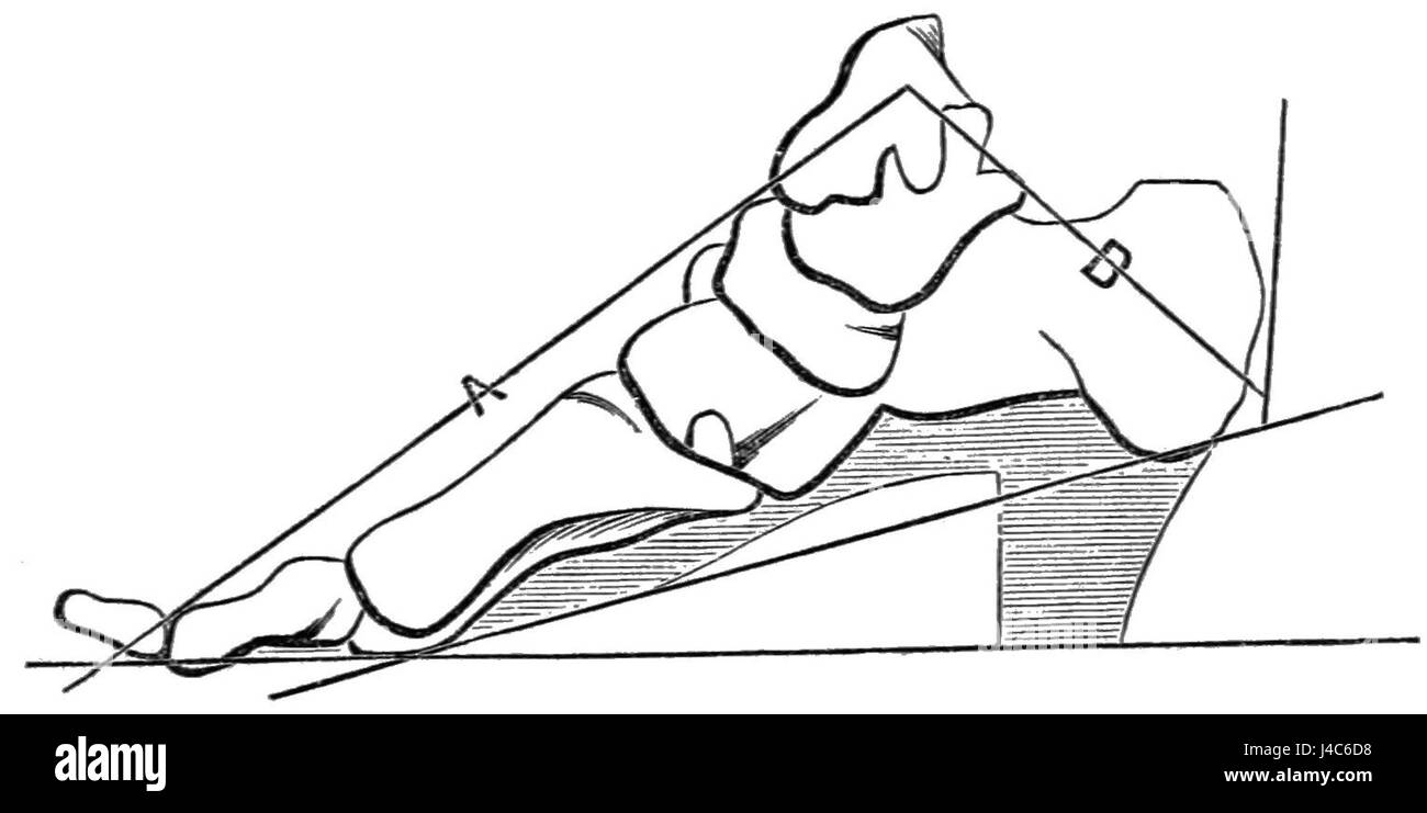 Body structure analysis Black and White Stock Photos & Images - Alamy