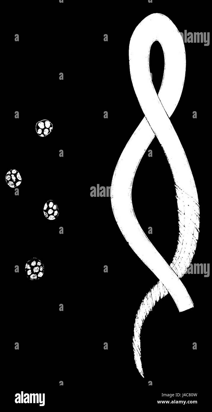 This entry refers to the spores and elaters of *Trichia chrysosperma ...