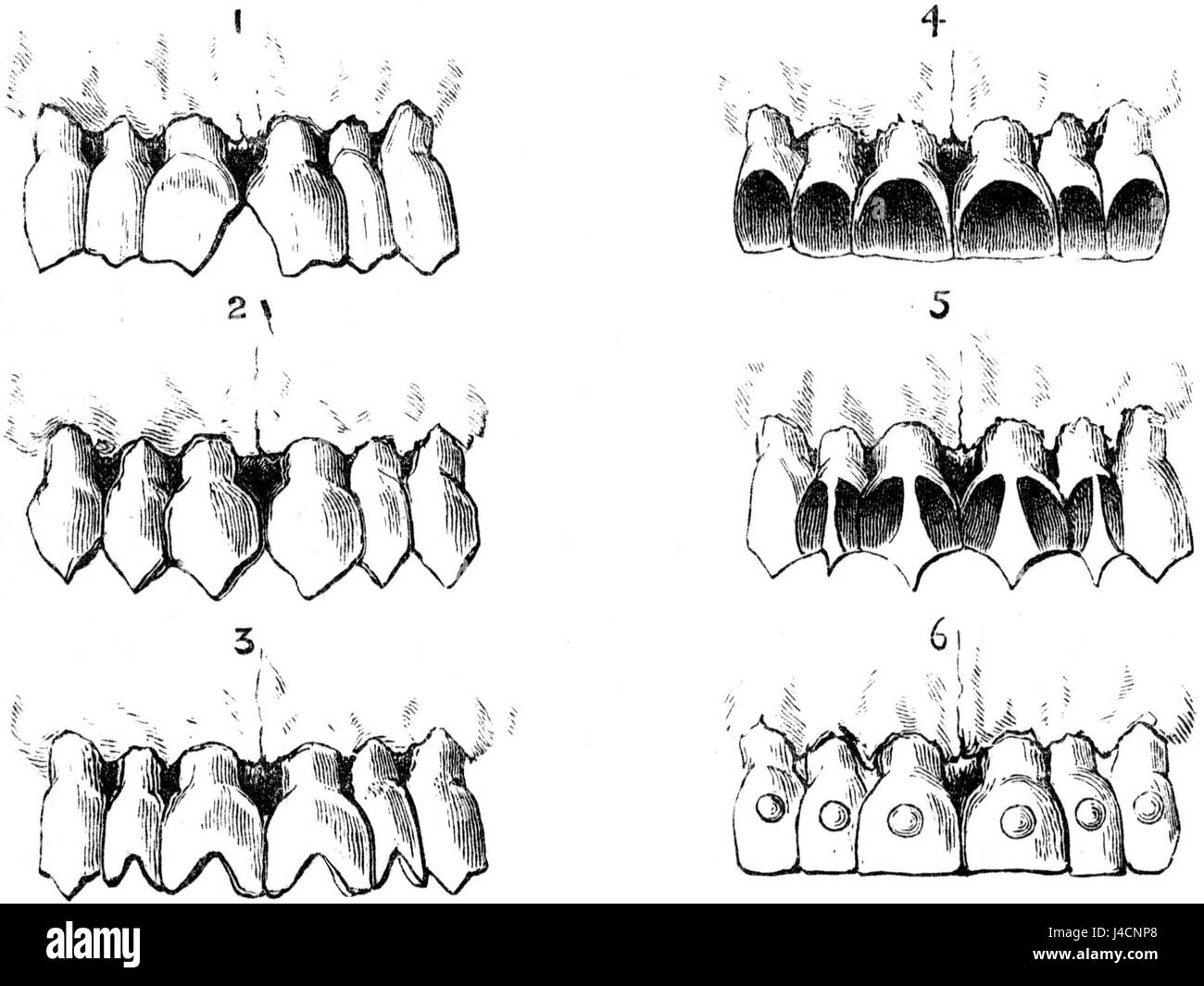 Upper front teeth Black and White Stock Photos & Images - Alamy