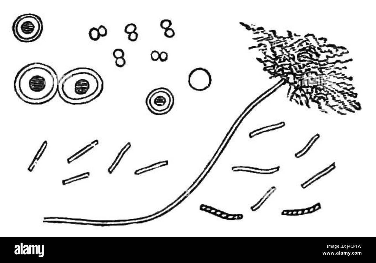 PSM V06 D418 Bacteria leptothrix and spore like bodies Stock Photo - Alamy