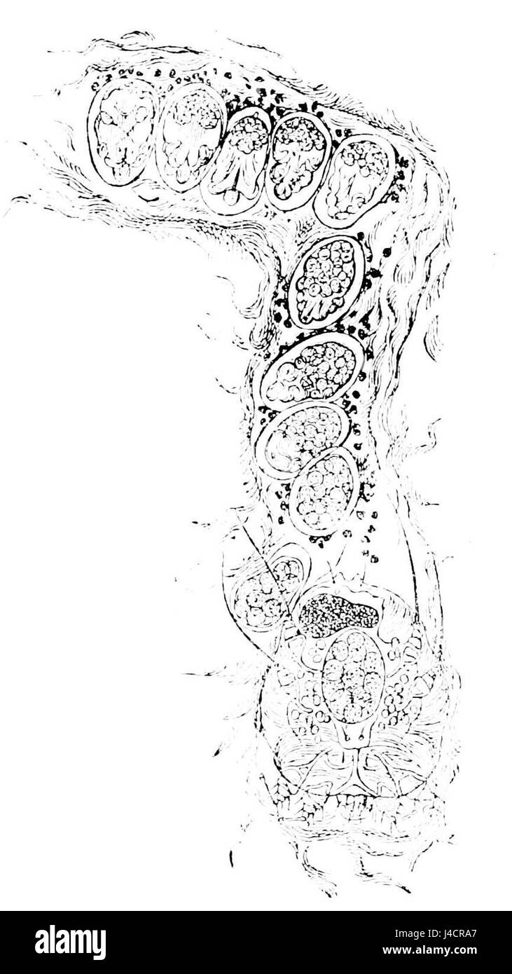 Itch drawing hi-res stock photography and images - Alamy