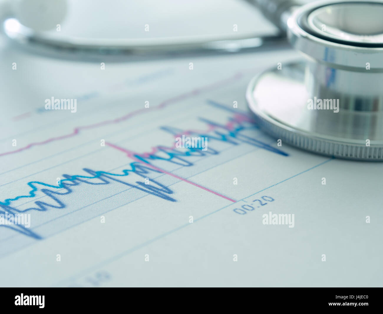 closeup Heartbeat graph on medical background Stock Photo - Alamy
