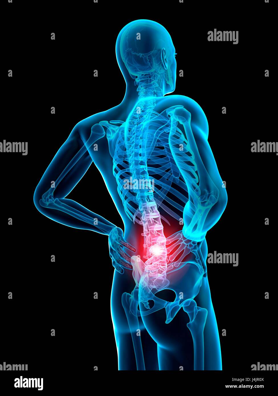 Human spine and back pain, illustration Stock Photo - Alamy
