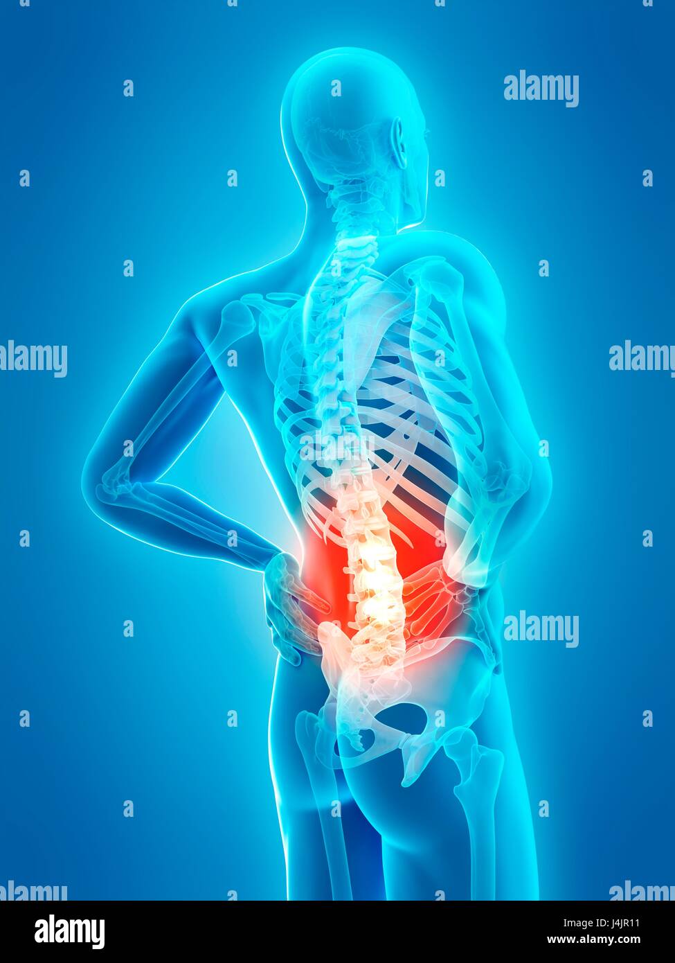 Human spine and back pain, illustration Stock Photo - Alamy