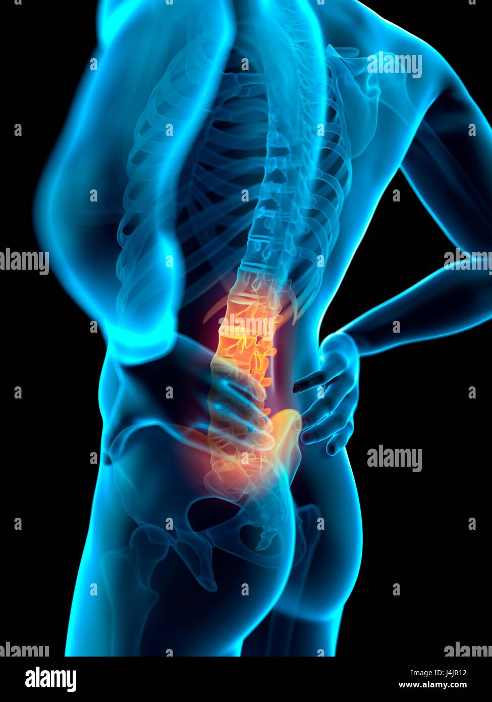 Human spine and back pain, illustration Stock Photo - Alamy